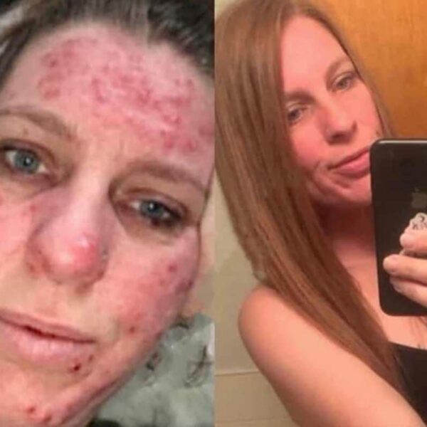 drug addiction problems and solutions